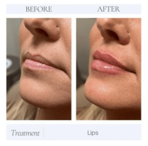 Plastic Surgery Knoxville, TN | Gallaher Plastic Surgery & Spa MD