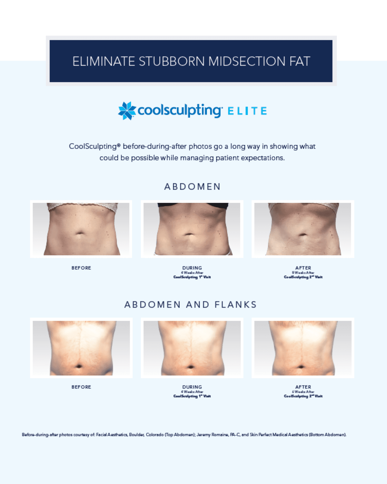 CoolSculpting® Elite in Knoxville, Tennessee | Gallaher Plastic Surgery ...