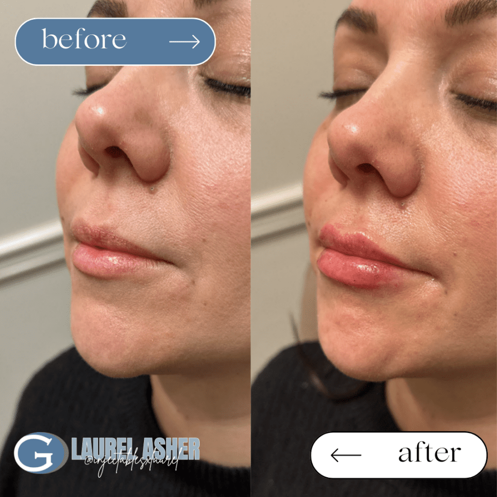 Plastic Surgery Knoxville, TN | Gallaher Plastic Surgery & Spa MD